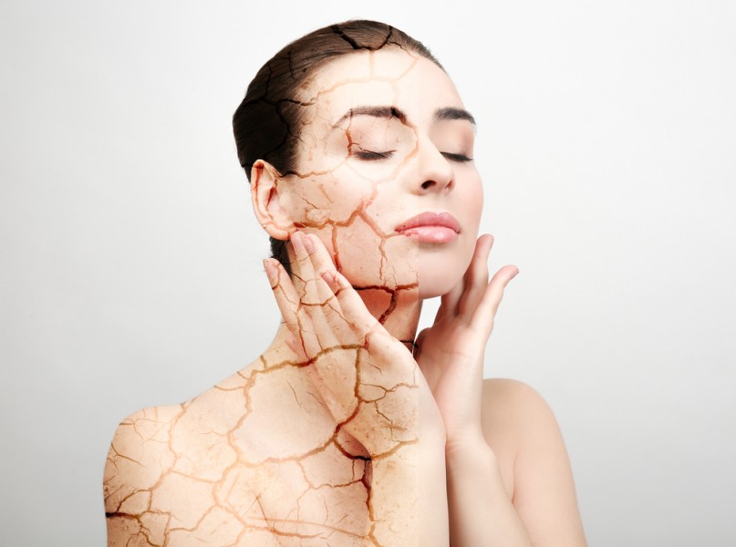 Crevasses : tout savoir sur ces fissures de la peau ! - Clinique de Vinci
